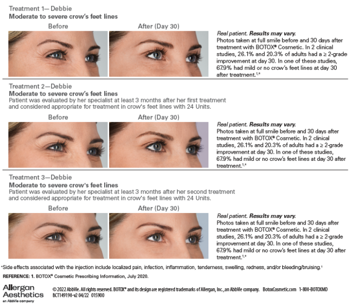 Botox - NW Medical Arts