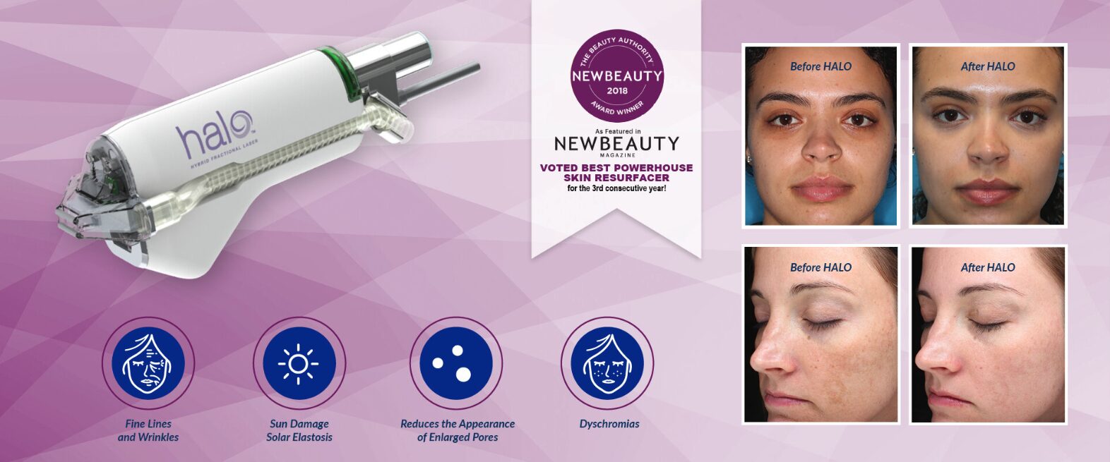 HALO Laser Treatment - NW Medical Arts