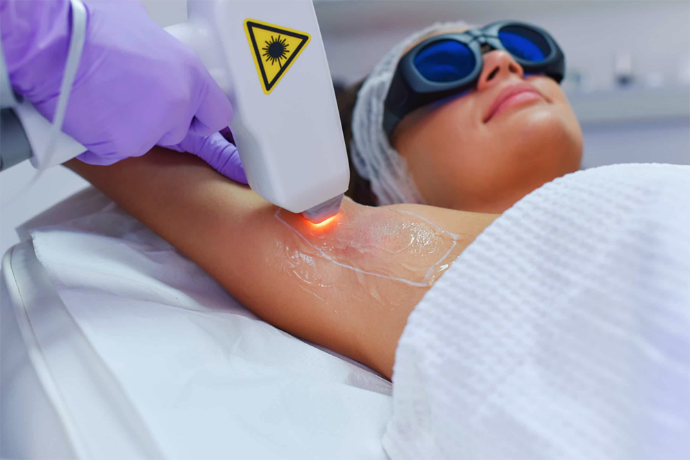 Laser Hair Removal Tacoma